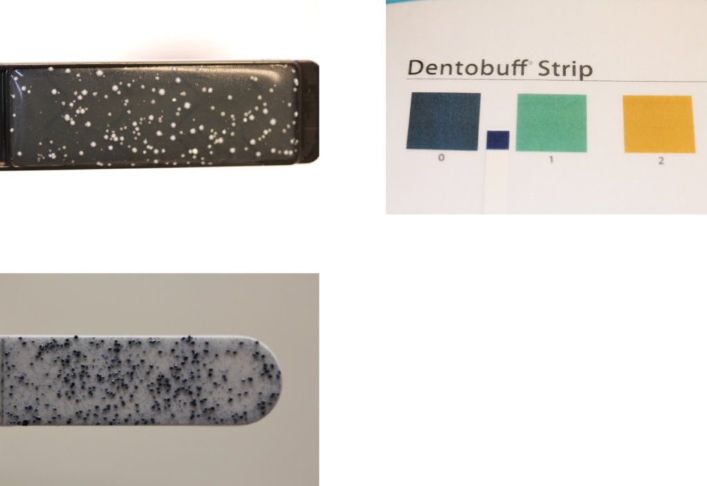 インプラント治療は痛い？よくある質問とその答え - ヒカルノ歯科｜歯の豆知識